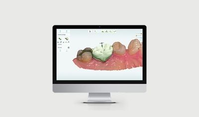 Schulungen zur digitalen Zahnheilkunde — 3Shape Community