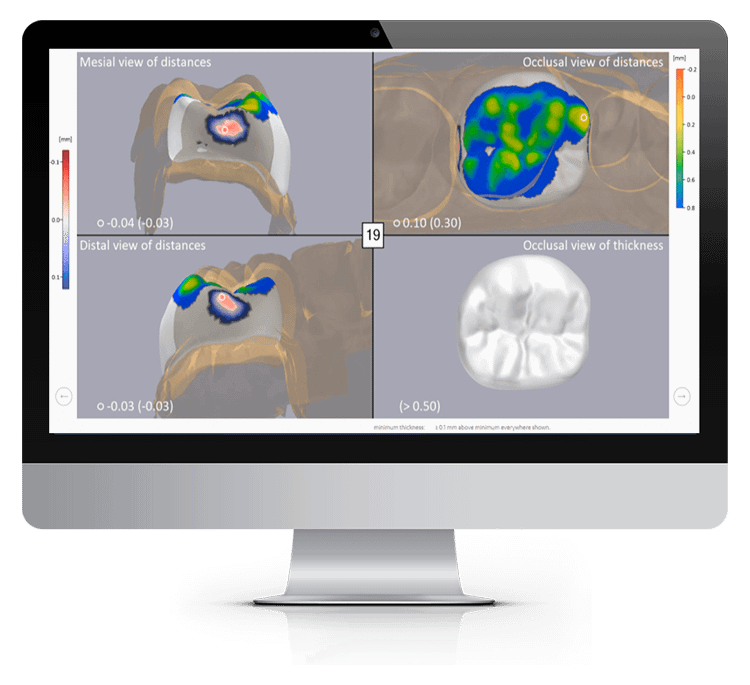 3Shape Automate — 人工智能牙科设计服务