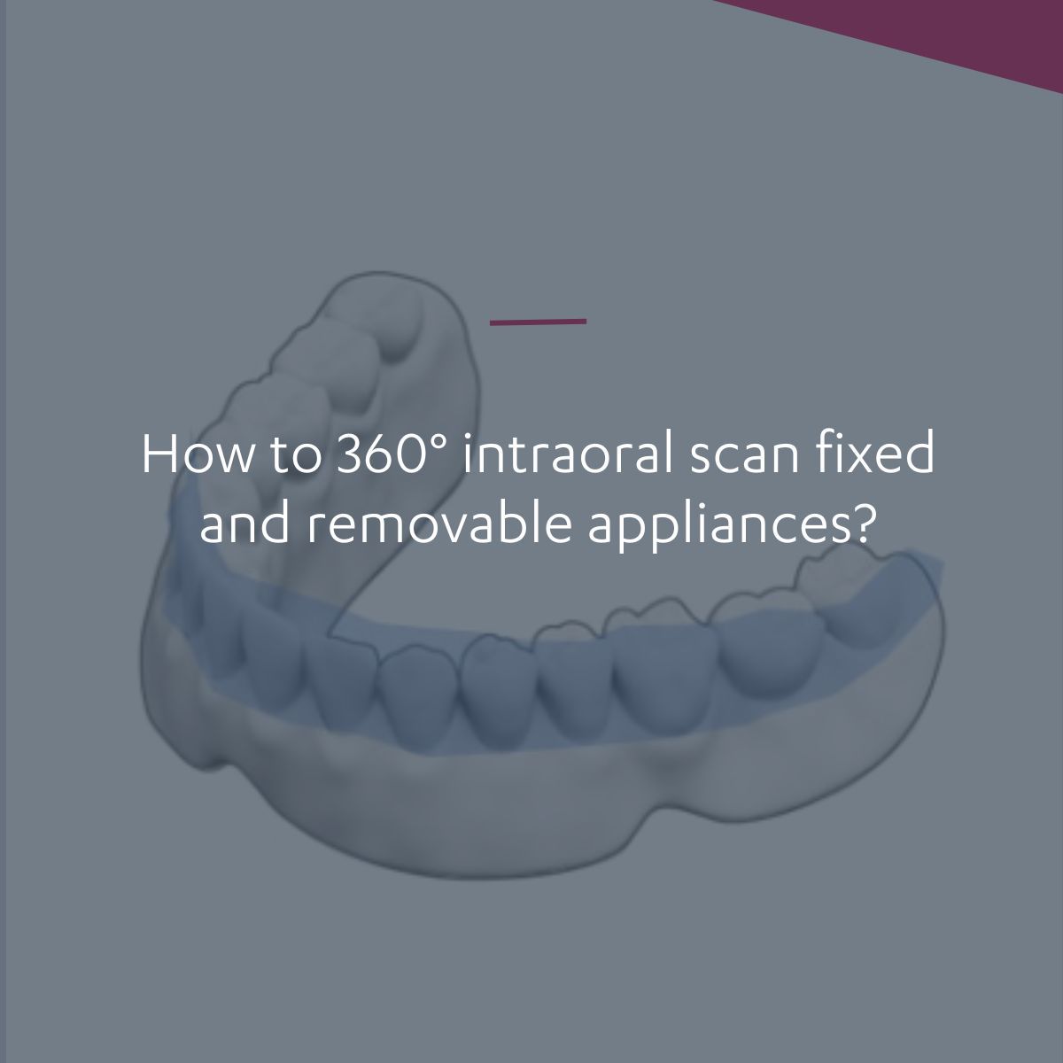Precision scanning for dentures - 3Shape Blog