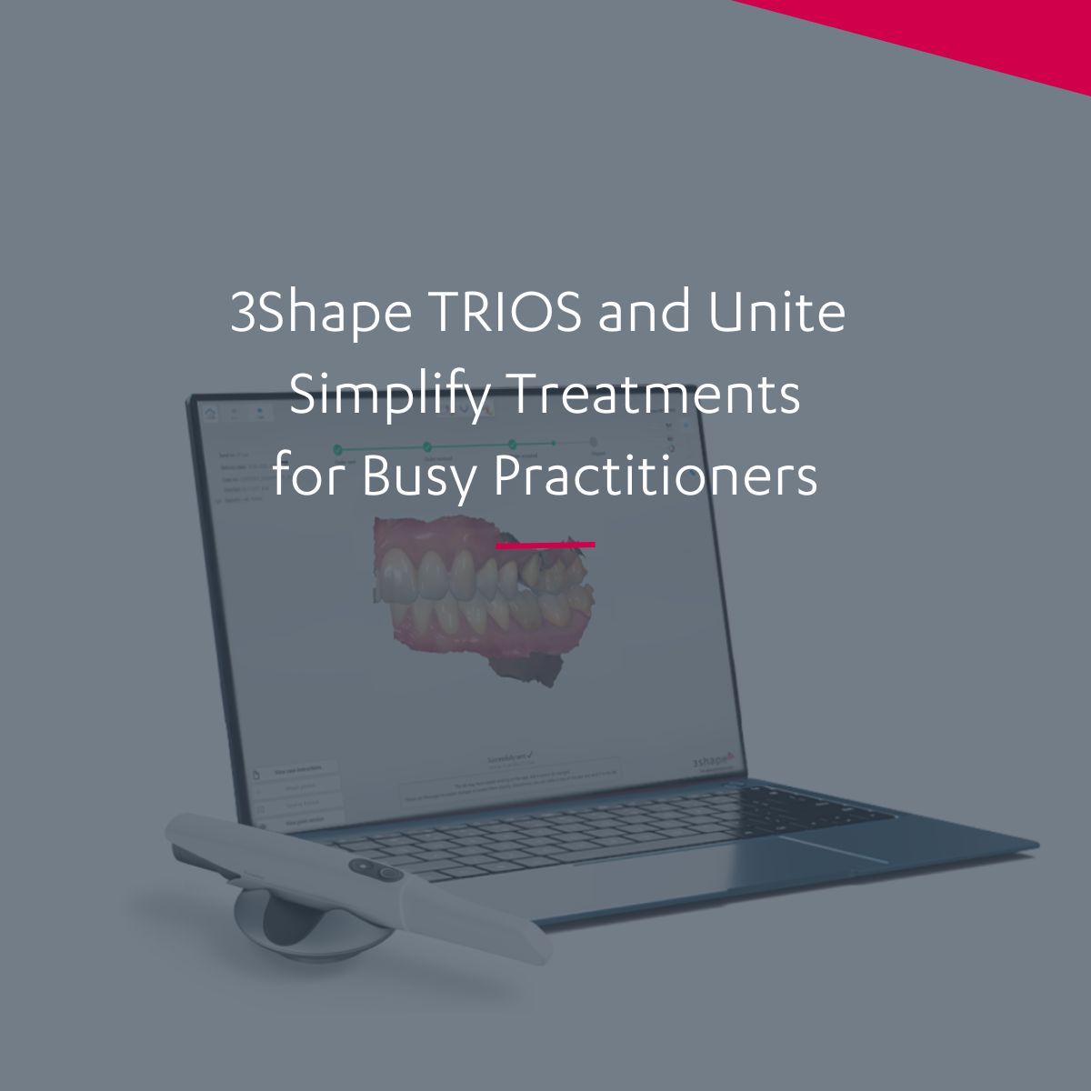 Efficient treatment plan with 3Shape Unite
