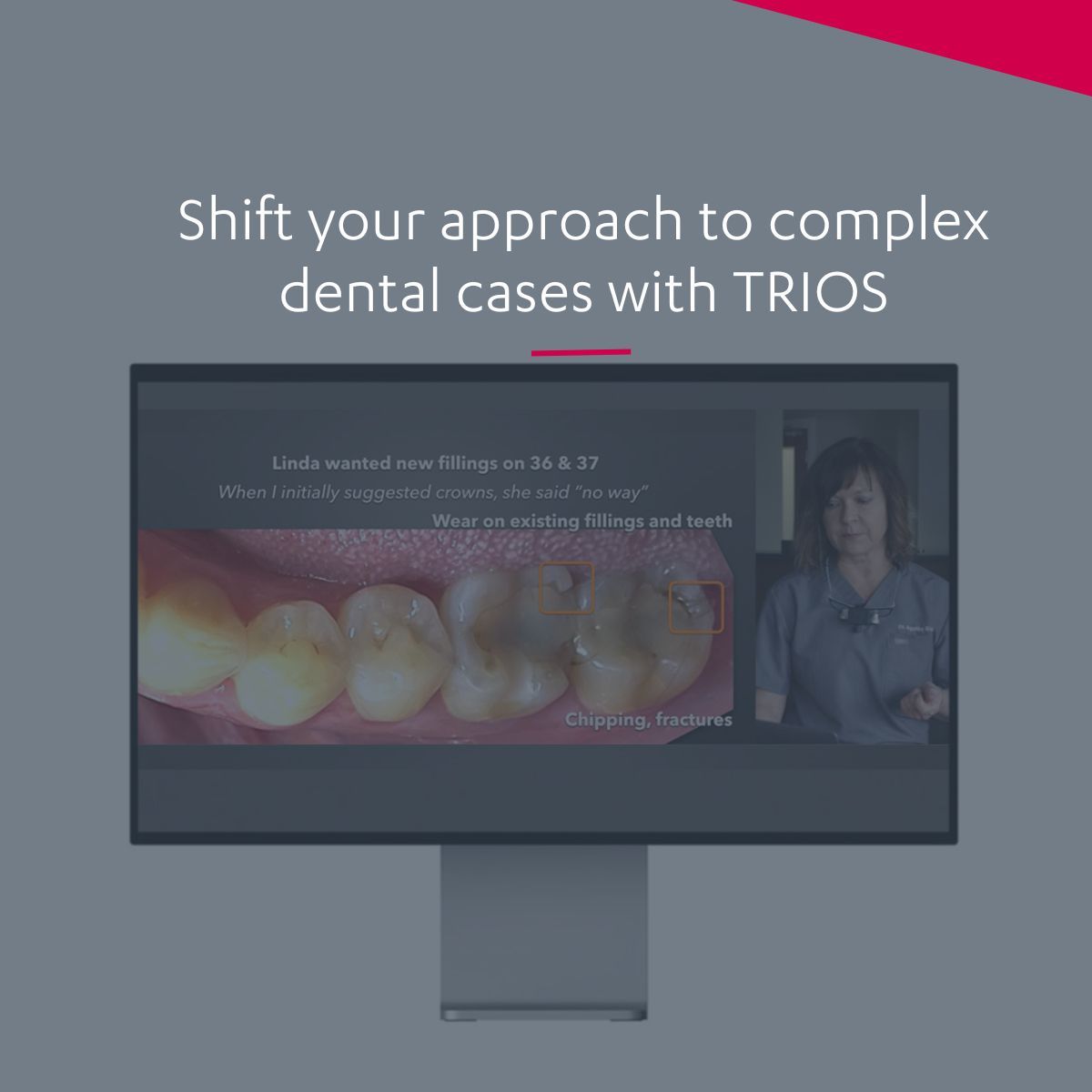 Shift your approach to complex dental cases with TRIOS – 3Shape Blog