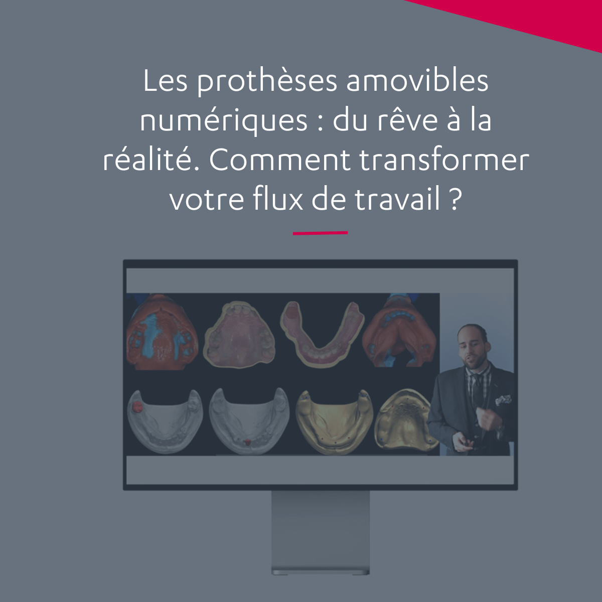 L'avenir de la fabrication de prothèses amovibles – Blog 3Shape