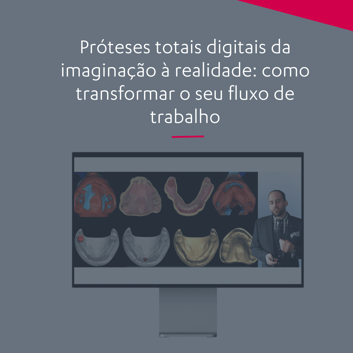 Fabricação de prótese total à prova de futuro – 3Shape Blog