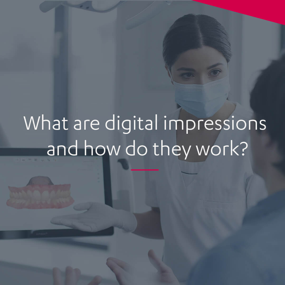 What are digital impressions and how do they work? – 3Shape Blog