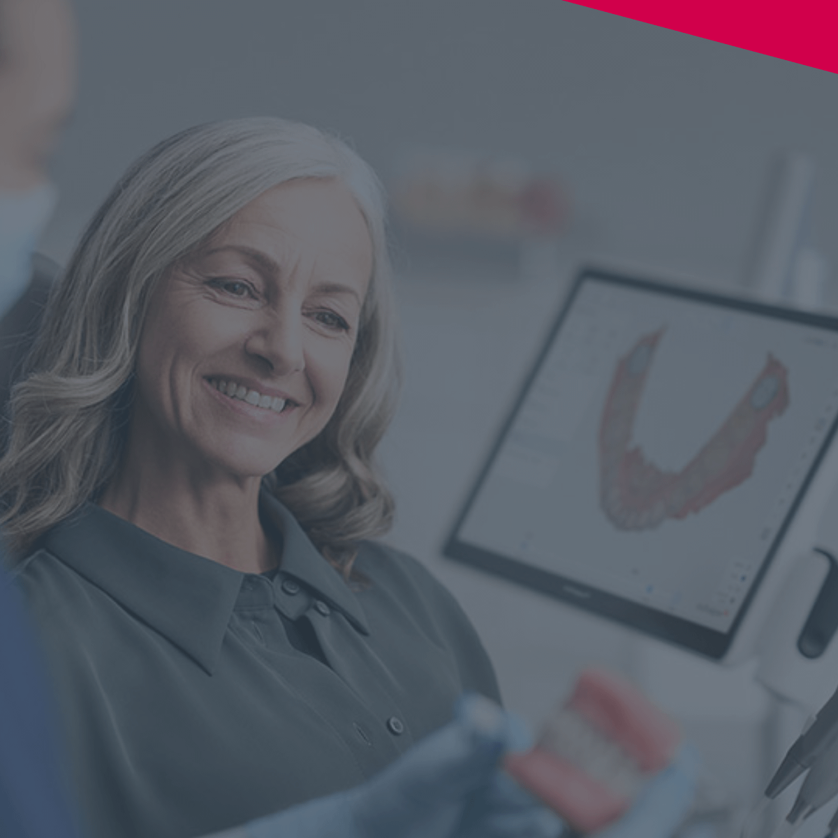 The mobile dental cart revolution in chairside – 3Shape Blog