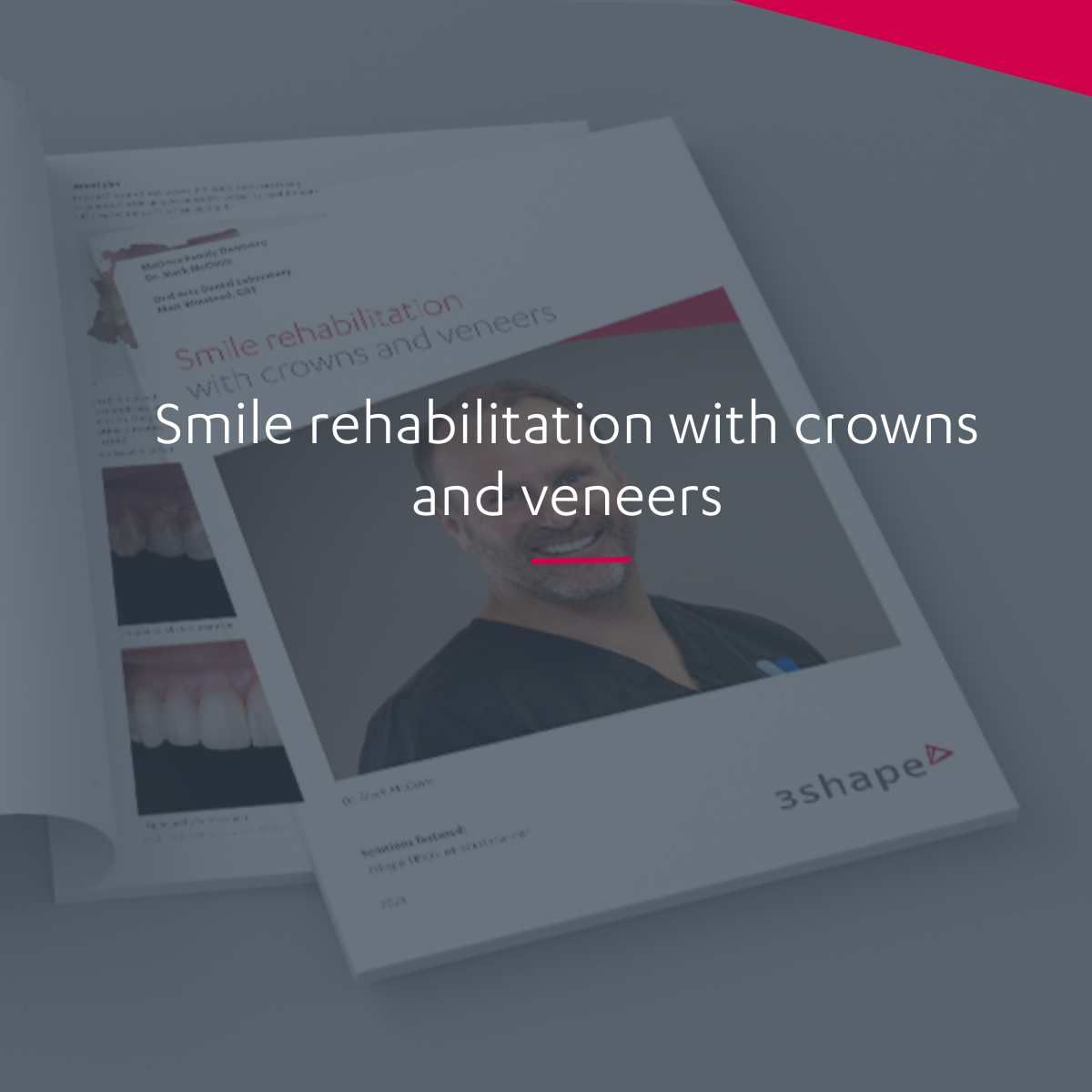 Digital workflow for smile rehabilitation