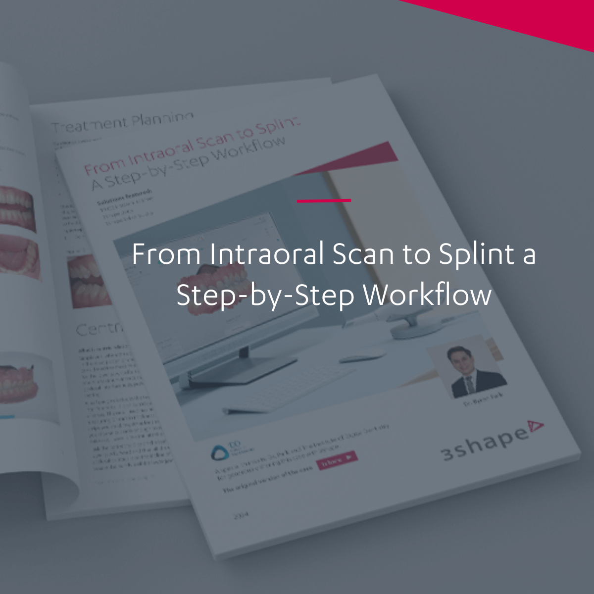 Step by step guide to designing and manufacturing a Bite Splint