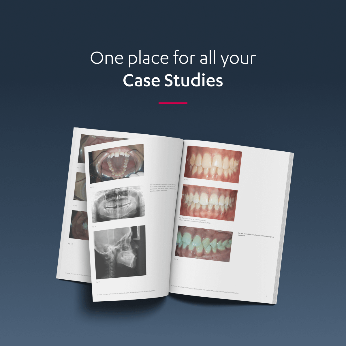 Case Studies — 3Shape