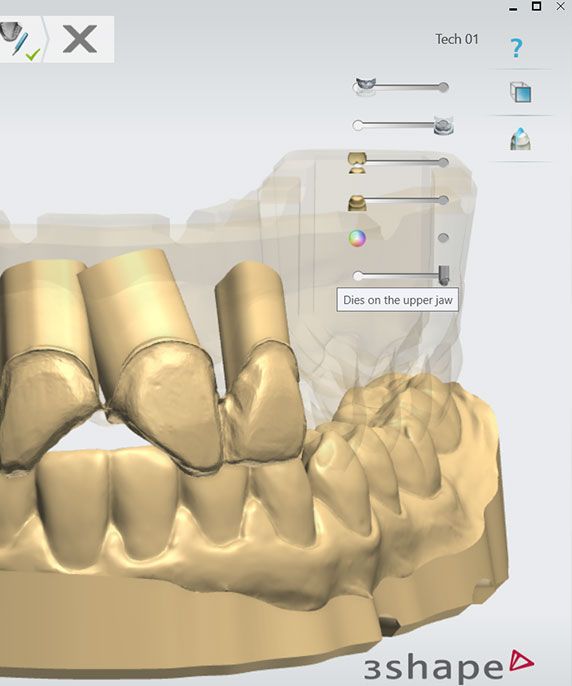 3Shape Dental System | Crack from Reversing Center