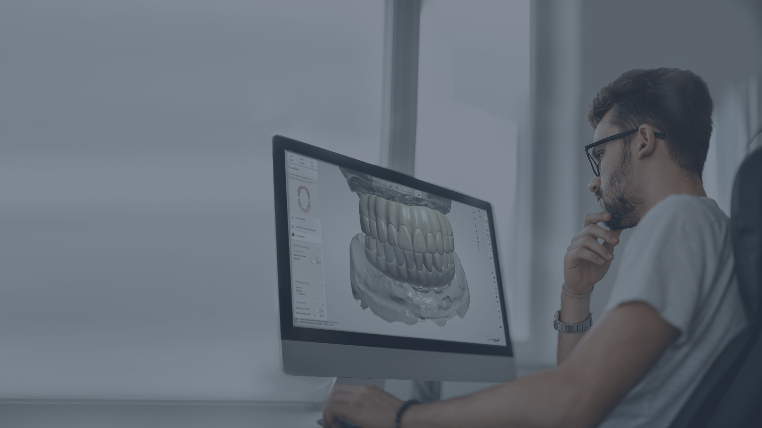 3Shape Design Service – professionnels dentaires