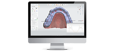 3Shape Orthodontic Planner - Intuitive Diagnosis & Treatment Analysis
