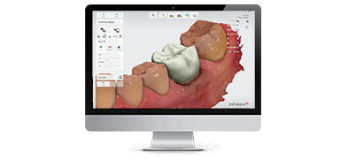3Shape Clear Aligner Studio - All-in-one Orthodontic Solution