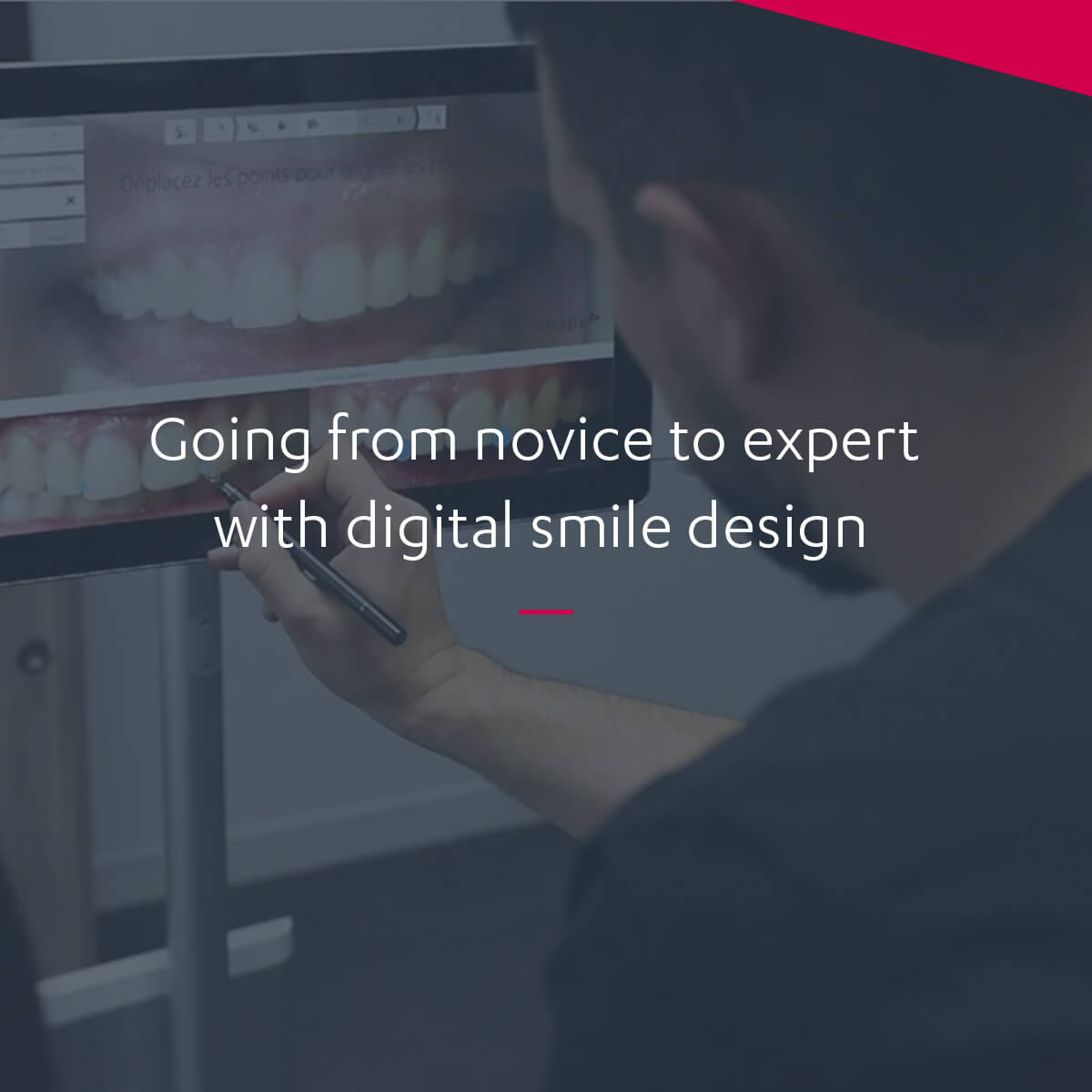 Follow this doctor's smile design journey - 3Shape Blog Follow this doctor's smile design journey - 3Shape Blog