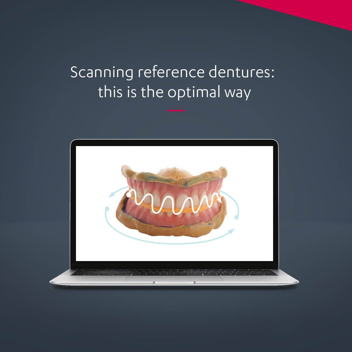 How To Scan Reference Dentures Download Guide 3shape Blog