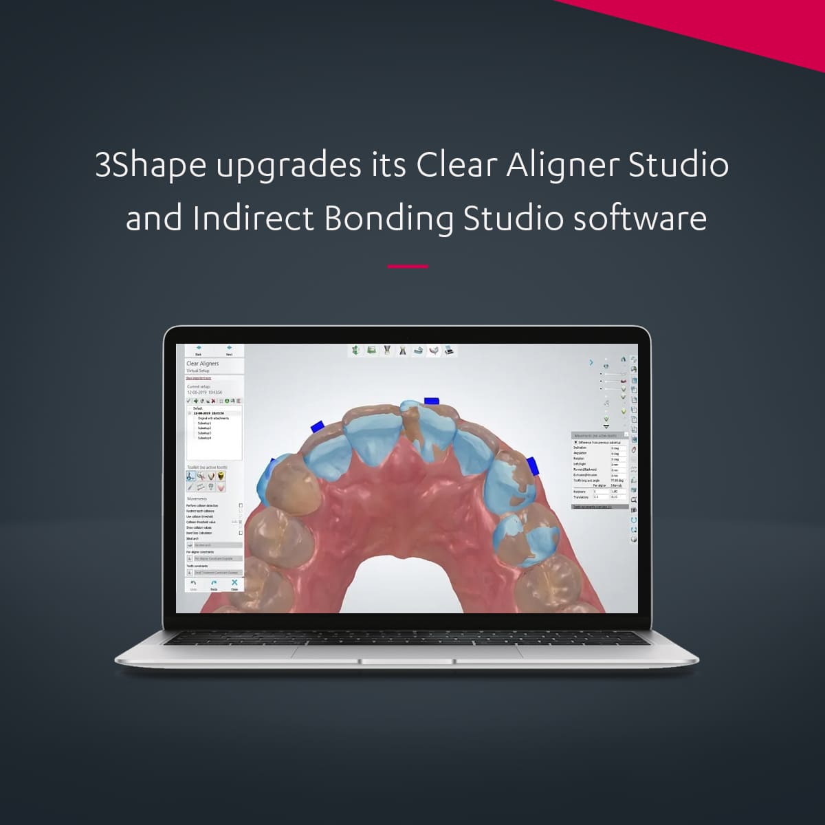3Shape announces software updates — 3Shape Press