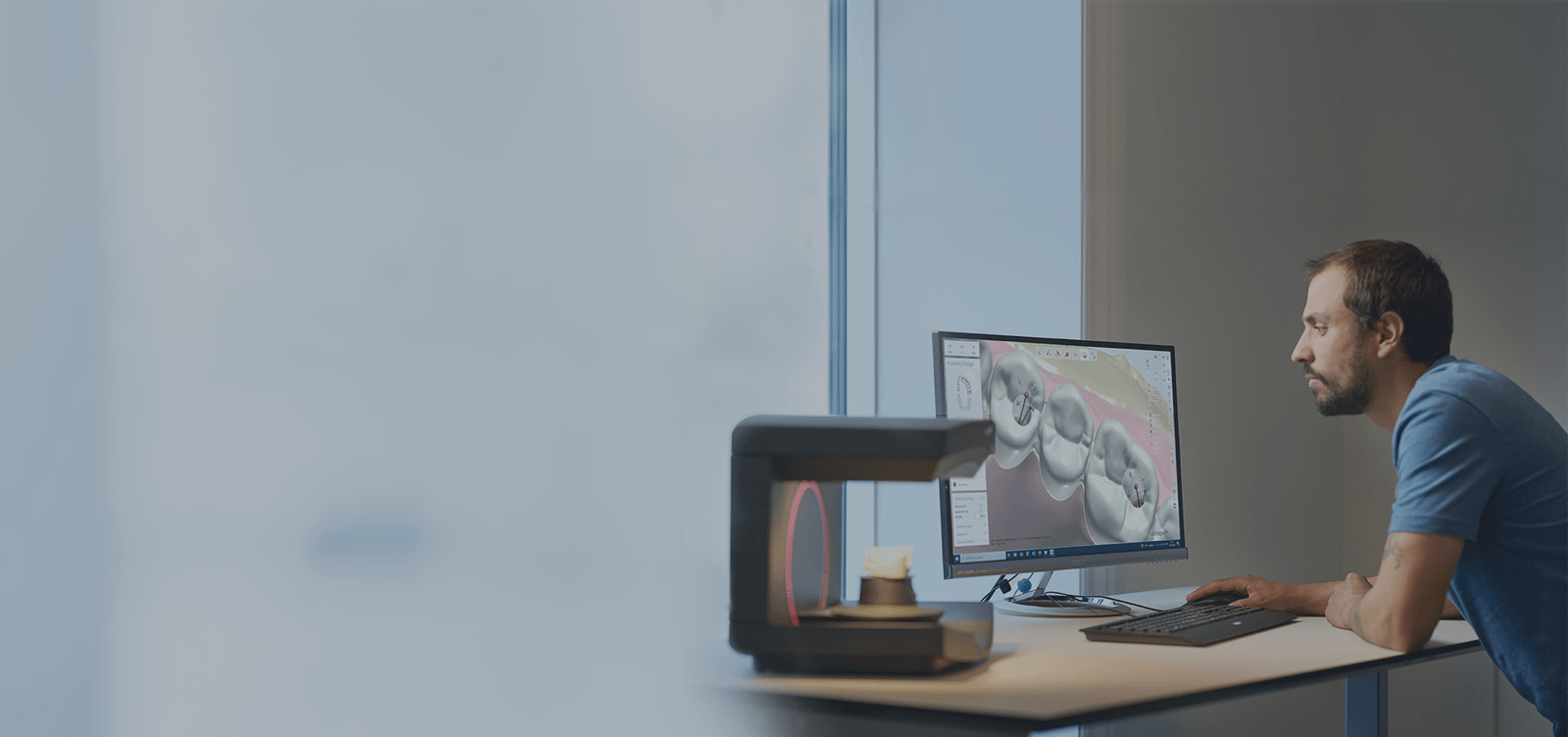 3Shape Dental System — Software Improvement and Changes