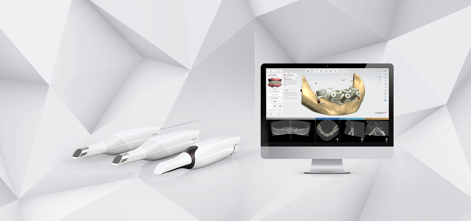 3Shape Implant Studio — Software Improvement and Changes