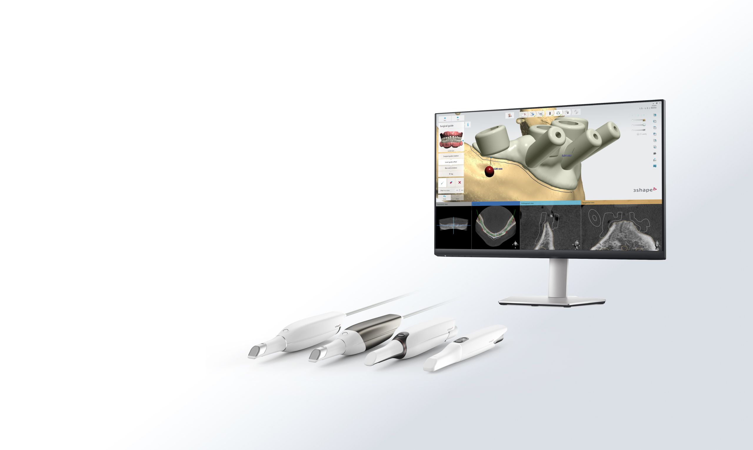 3Shape Implant Studio — Software Improvement and Changes