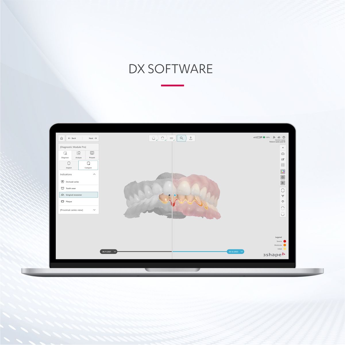 Dx Plus – Diagnostics with 3Shape