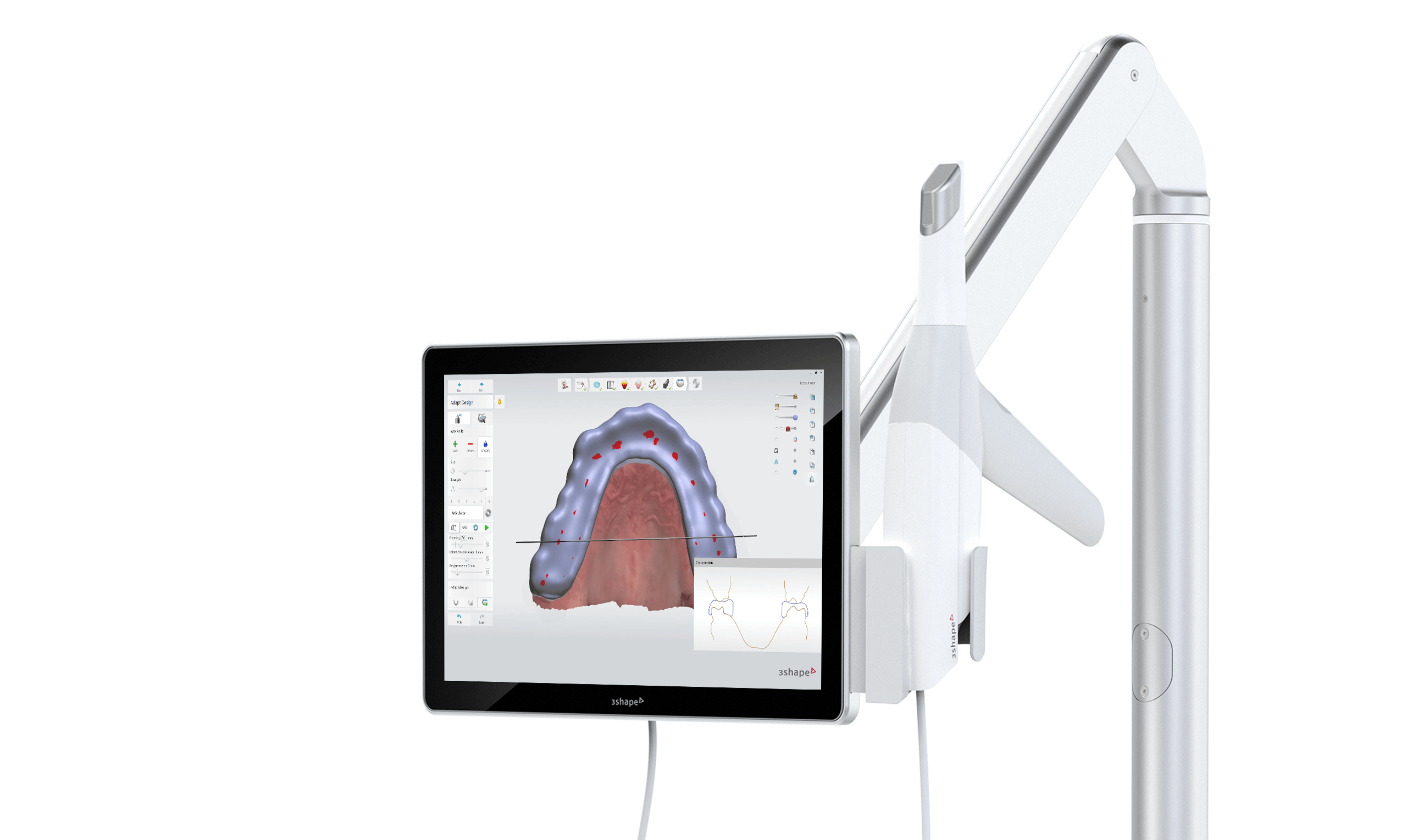 3Shape Splint Studio: Design occlusal splints